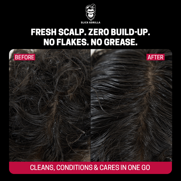 Scalp Scrub | Scalp Exfoliation | Hair Scrub | Slick Gorilla